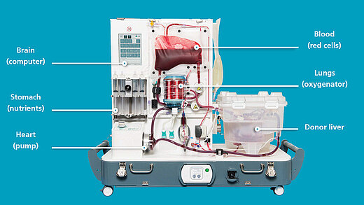 New prospects for liver transplants – RAUMEDIC