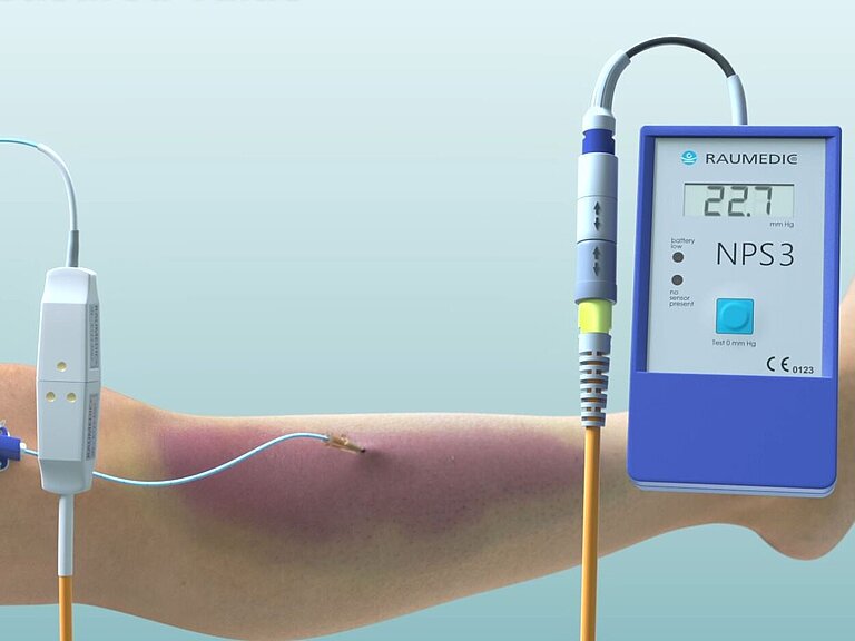 Solutions for Traumatology – RAUMEDIC