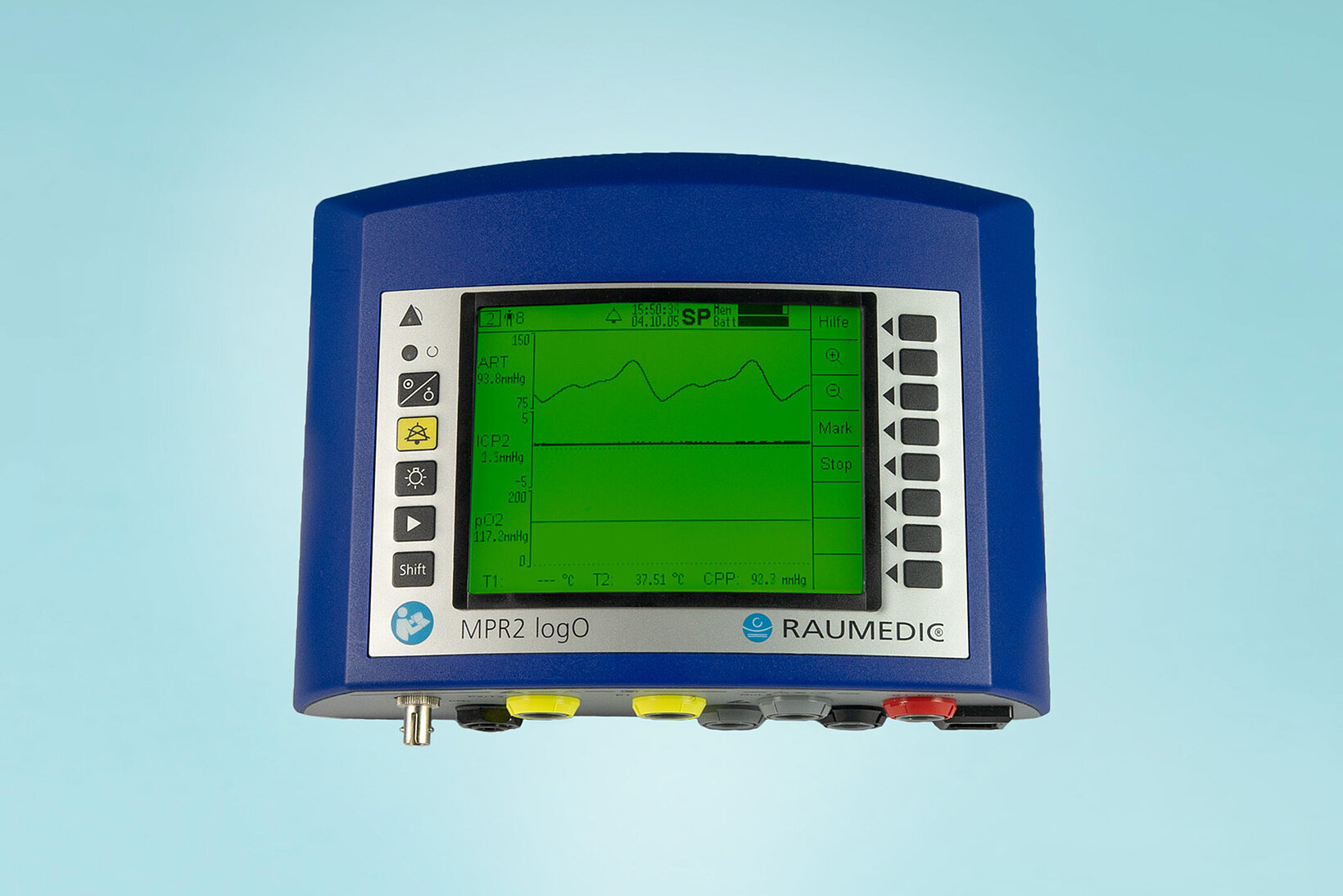 Multifunctional Datalogger and Display Devices for Neuromonitoring ...