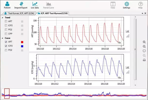 Software for transferring measured medical data to a PC – RAUMEDIC