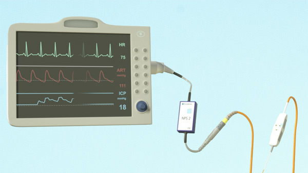 Precise measurement of intracranial pressure – RAUMEDIC